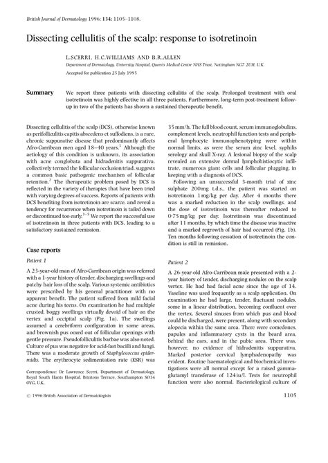 Dissecting Cellulitis Of The Scalp Response To Isotretinoin Docslib