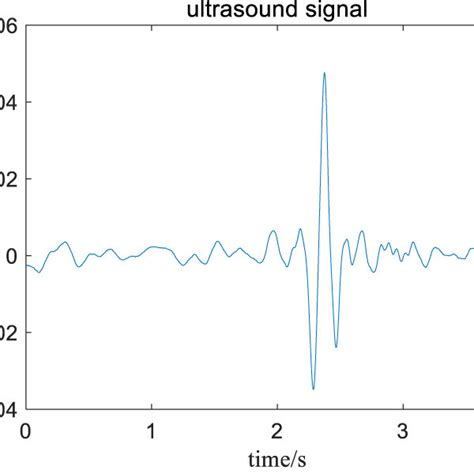 Acoustic Pressure Signal Of Transducer Download Scientific Diagram