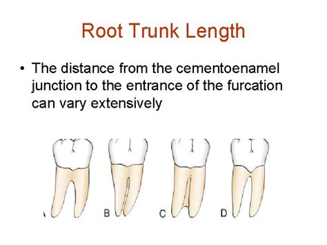 Furcation Deffinition The Furcation Is An Area Of