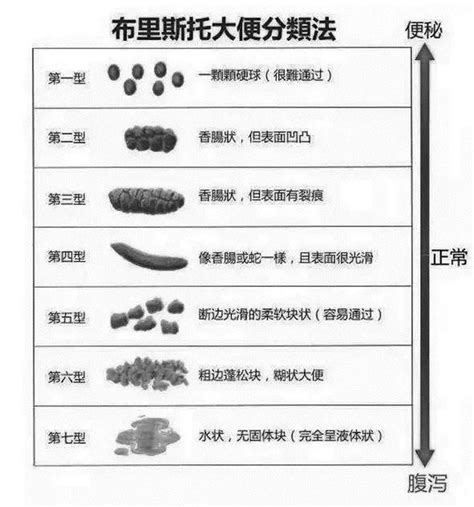 察颜观色辨形便便透露着你的健康 水样