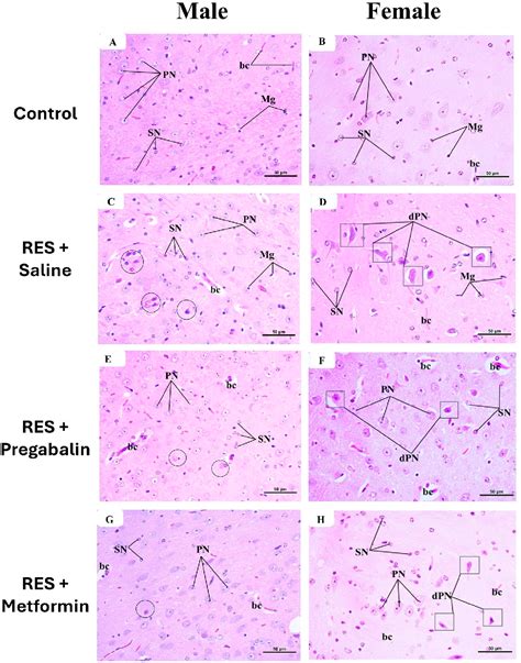 Figure 11 From The Antinociceptive Effects And Sex Specific Neurotransmitter Modulation Of
