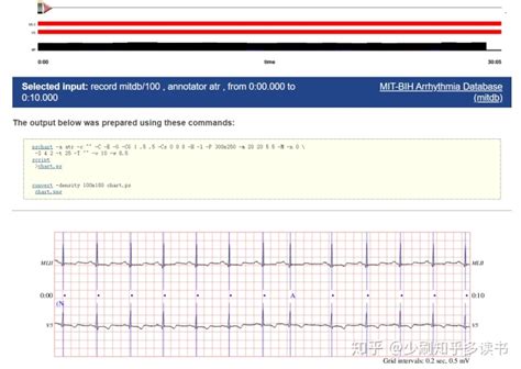 matlab 保存图片大小尺寸 基于机器学习的心律失常分类 二 ——读取mit bih数据库中的心电数据[matlab] 司幽幽的博客
