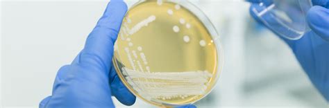 Bioburden Testing Viroxy