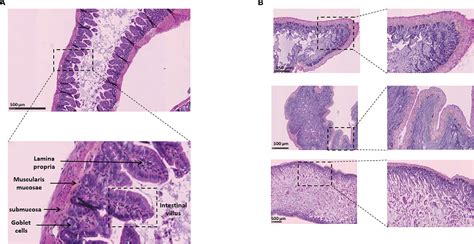 Figure 11 From Control Of Cdh1e Cadherin Gene Expression And Release