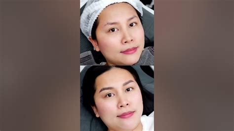 คุณซอ จาก สะใภ้เกาหลี กลับไทยรอบนี้ คิ้วอ่อนรอยแผลเป็นต้องหายไป จัดคิ้วแฮร์สโตรกไปให้เกาหลี