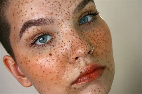 Faux Freckles Album On Imgur