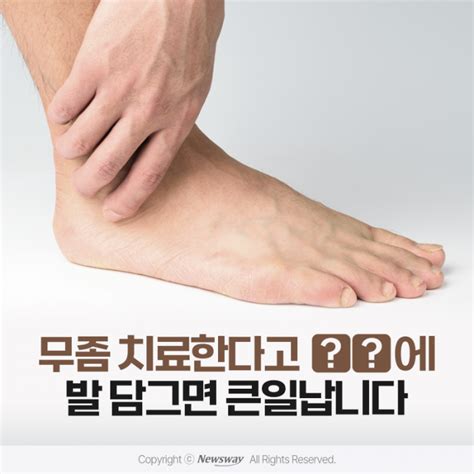 무좀 치료한다고 에 발 담그면 큰일납니다 뉴스웨이