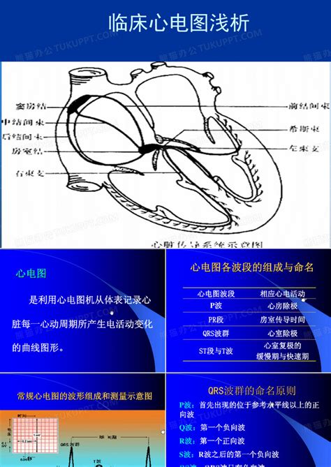 心电图PPT模板下载 编号qkpdexwa 熊猫办公
