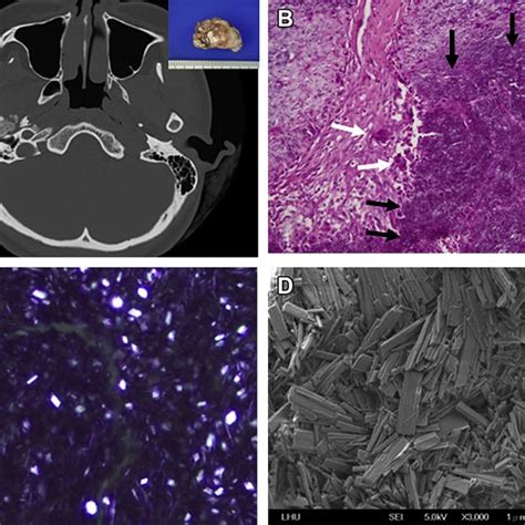 Computed Tomographic Ct Light Microscopic And Scanning Electron