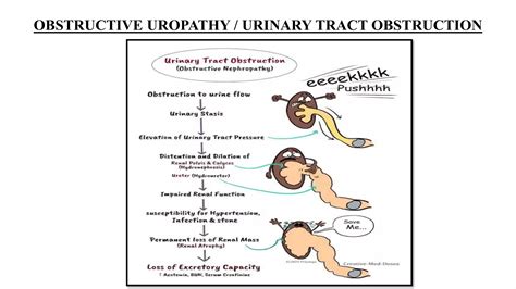 Obstructive Uropathy Ppt Pptx