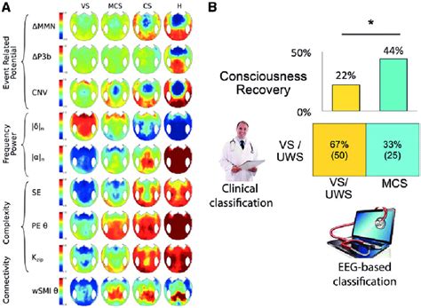 A Scalp Topography Of Markers Of Event Related Potentials Spectral Download Scientific