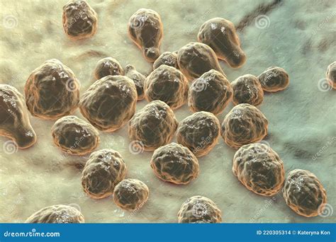 Pulmonary Cryptococcosis Invasion Of A Lung Tissue By Yeast Fungi Cryptococcus Neoformans With