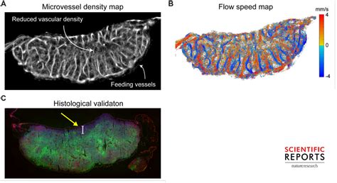 Ccil Member Using Super Resolution Ultrasound Localization Microscopy To Measure Hypoxia