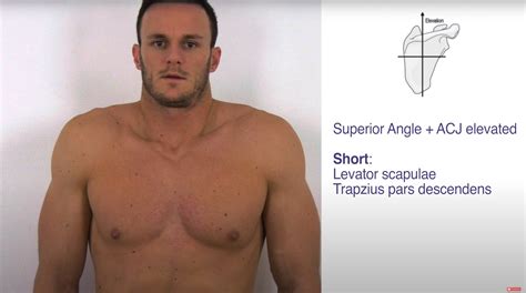 Scapular Alignment Scapular Dyskinesis Assessment 43 Off