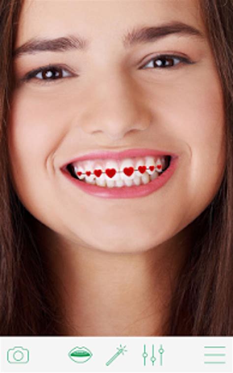 Braces Apk สำหรับ Android ดาวน์โหลด