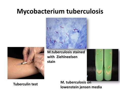 Lab Diagnosis Od Meningitis Pdf