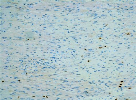 Ihc Analysis ×200 The Cellular Proliferation Index Ki67 Was Download Scientific Diagram