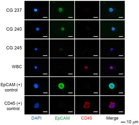 Cancer Panel Analysis Of Circulating Tumor Cells In Patients With Breast Cancer