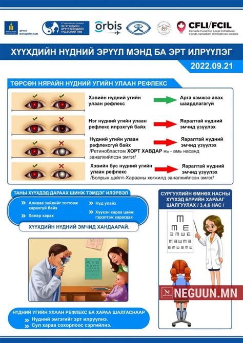 ХҮҮХДИЙН НҮДНИЙ ЭРҮҮЛ МЭНД БА ЭРТ ИЛРҮҮЛЭГ Neguun Mn Мэдээллийн анхдагч бодит эх сурвалж