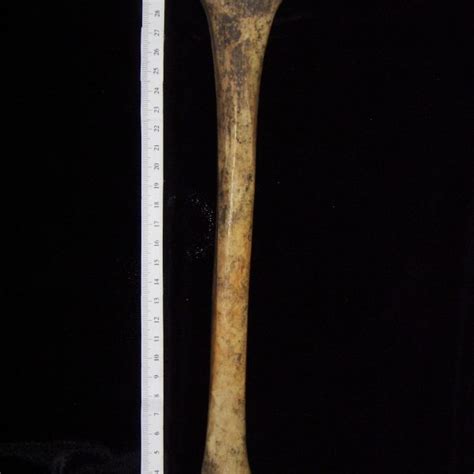 Human Left Tibia Posterior View Boneid