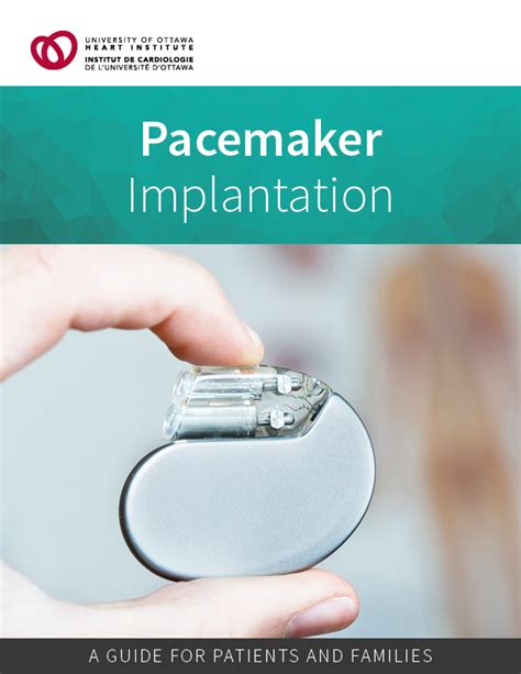 Pacemaker Implantation Patient Guide University Of Ottawa Heart Institute