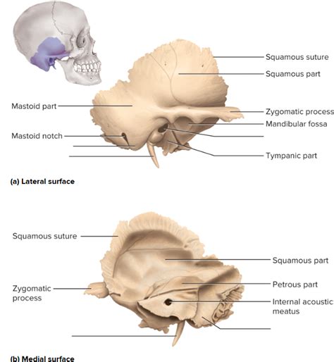 Right Temporal Bone Lateral Medial Surface Diagram Quizlet