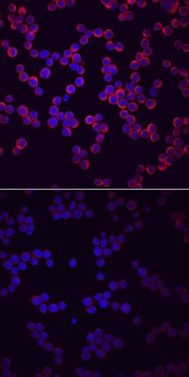 Plc Gamma 2 Antibodies Novus Biologicals