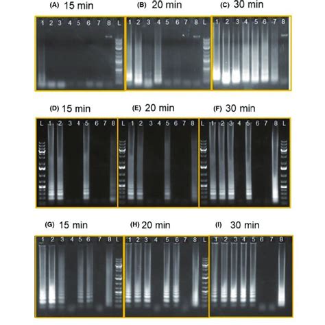 Colorimetric Rt Lamp Assay Using N15 Primers A Colour Of Reaction Download Scientific Diagram