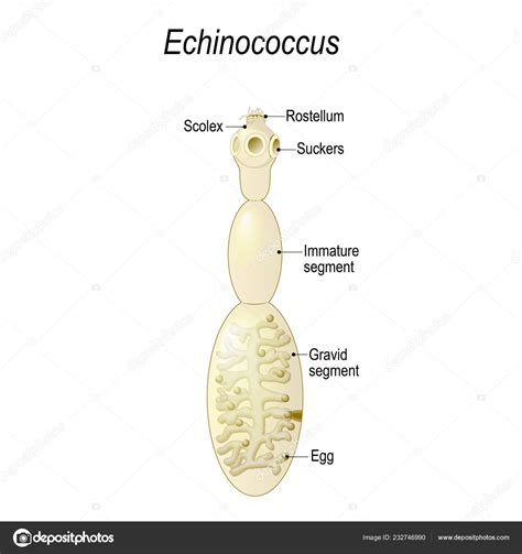 Echinococcosis Ct Cmdt Media Library Accessmedicine Mcgraw Hill Medical