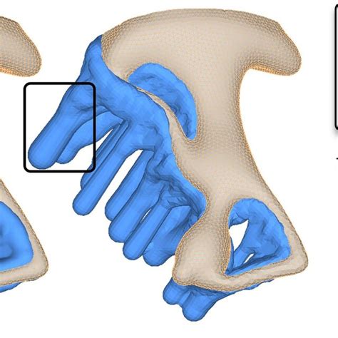 Comparison Of The Implicit Surface Of Support Structure Building With