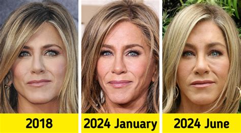 What Happened To Jennifer Anistons Face She Looks Different Now