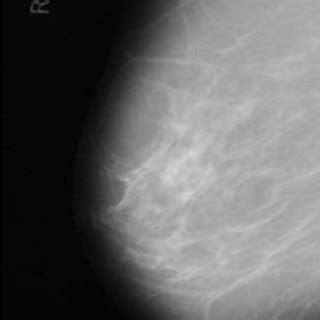 Comparison of conventional and c edge images with ρ 3 a The Download High Resolution