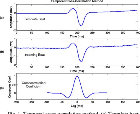 Figure 1 From A New Alignment Method Based On The Wavelet Multi Scale