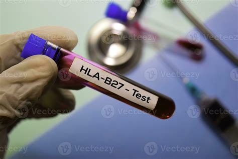 HLA B27 Test With Blood Sample Top View Isolated On Office Desk Healthcare Medical Concept