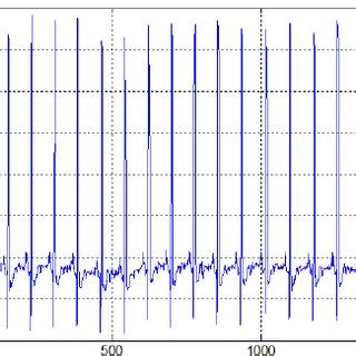 Pdf An Approach For Ecg Feature Extraction Using Daubechies Db Wavelet