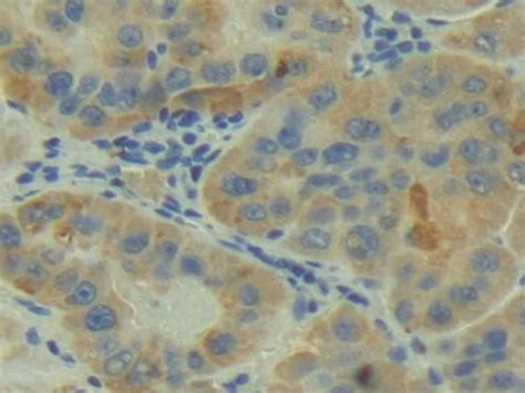 C2 Polyclonal Antibody Invitrogen 20 μl Unconjugatedantibodies