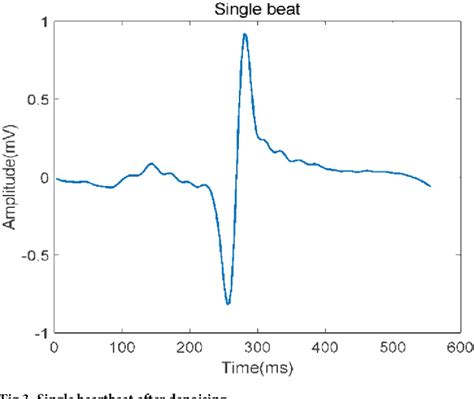 figure 3 from classification of ecg signal using fft based improved alexnet classifier