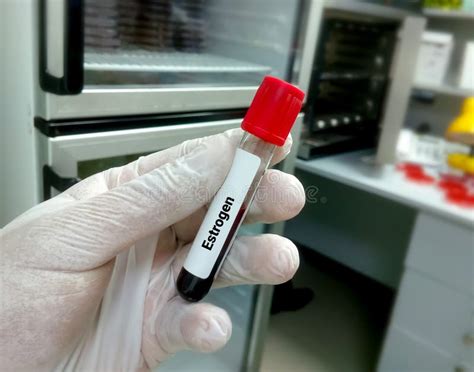 Blood Sample For Estrogen Hormone Test Female Sex Hormone Estradiol Stock Photo Image Of