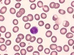 Lab Midterm Flashcards Quizlet Lab Midterm Flashcards Quizlet