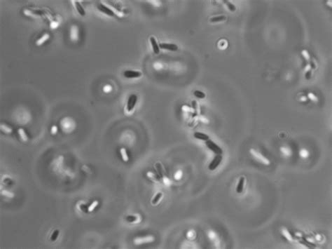 Lactobacillus Plantarum Viticulture And Enology