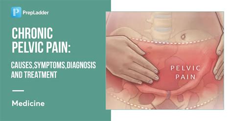 Chronic Pelvic Pain Causes Symptoms Diagnosis And Treatment
