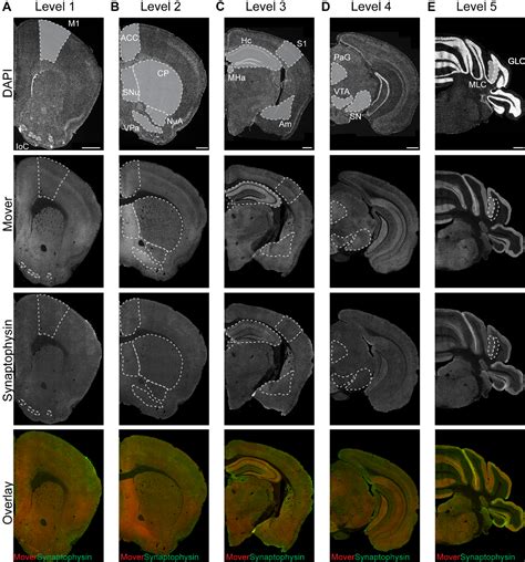 Quantifying The Heterogeneous Distribution Of A Synaptic Protein In The Mouse Brain Using