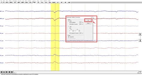Shutdown Of The Besa Research 60 When I Apply The Automatic Artifact Correction To Correct