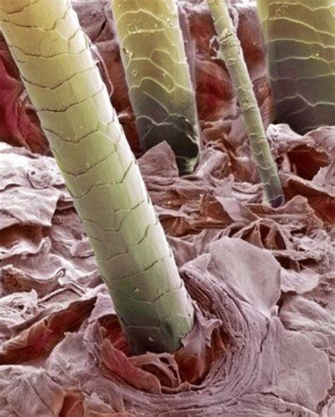 Best Scalp Problems Images On Pinterest Scalp Problems Hair Care And Hair Follicles