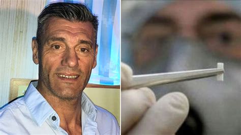 El Chip Sexual Es Tendencia Cada Vez Más Hombres Van A La Ginecóloga