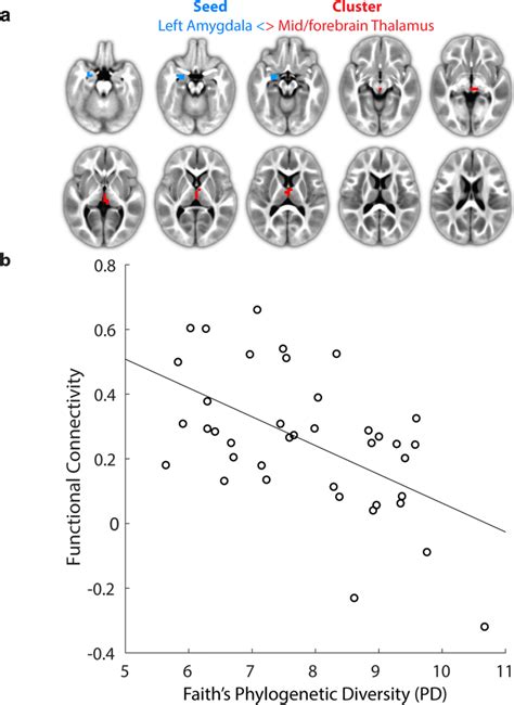 Functional Connectivity Between The Left Amygdala Seed Region Blue Download Scientific