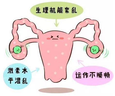原发性痛经多图 39医疗图集 39健康网