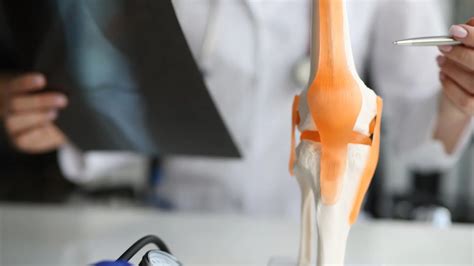 Monovisc Knee Injection Reviews Medica Depot