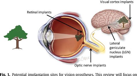 Figure 1 From An Update On Retinal Prostheses Semantic Scholar