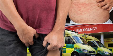 Scabies Uk Outbreak Symptoms To Spot